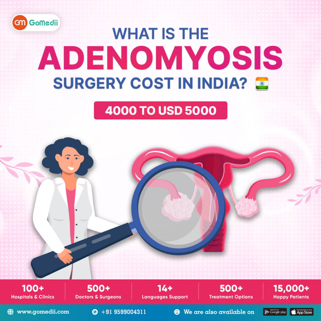 What Is The Adenomyosis Surgery Cost In India? - GoMedii Blog