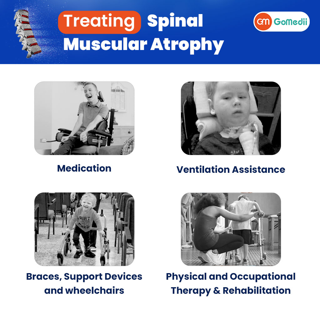 Spinal Muscular Atrophy Treatment Cost in India