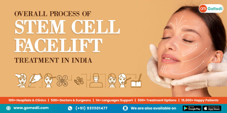 Overall process of Stem Cell Facelift Treatment in India - GoMedii Blog