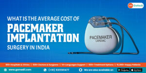 What is the average cost of pacemaker Implantation surgery in India